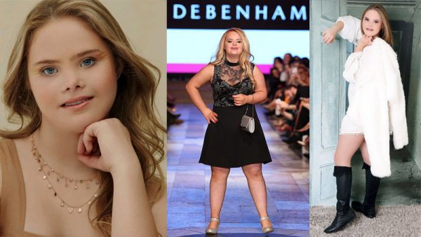 แตกต่างแต่เท่าเทียม สาวดาวน์ซินโดรม เดินตามฝัน เซ็นสัญญาโมเดลลิ่ง ถึง 5 ...