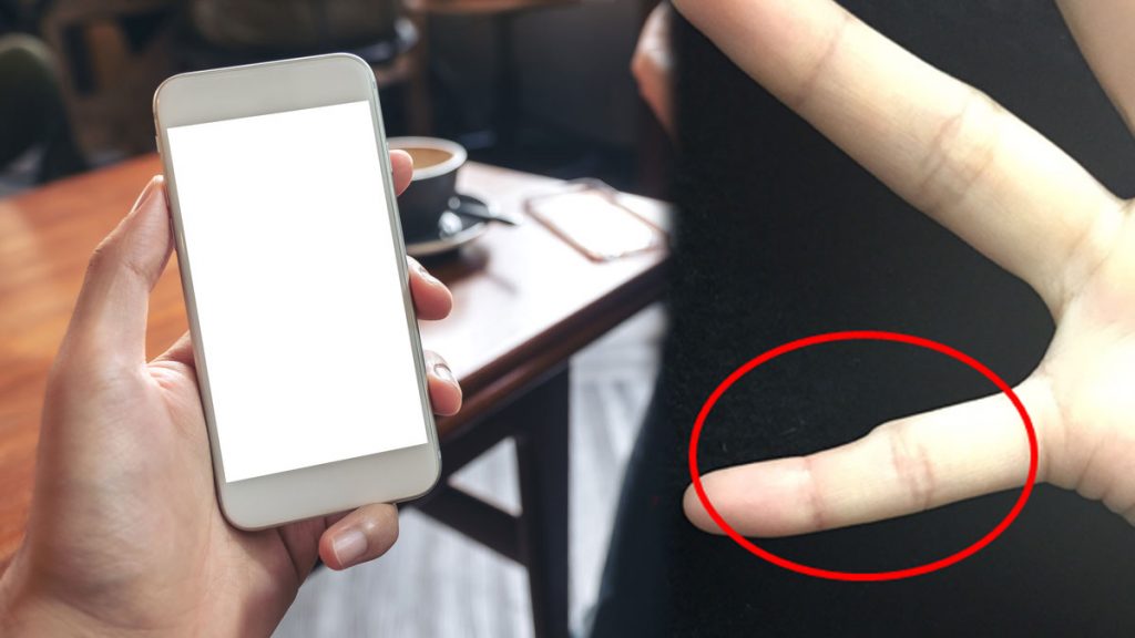 Smartphone Pinky นิ้วก้อยงอ จากการใช้โทรศัพท์มือถือนานเกินไป!!