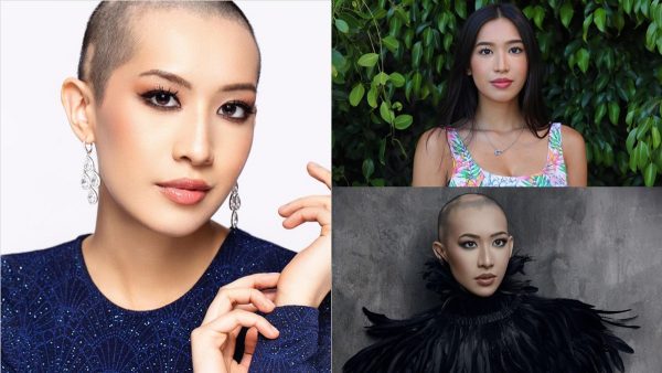 Renee Reyes นางงามหัวล้าน ที่คนทั่วโลกตกหลุมรักความสวย ในแบบที่เธอเป็น