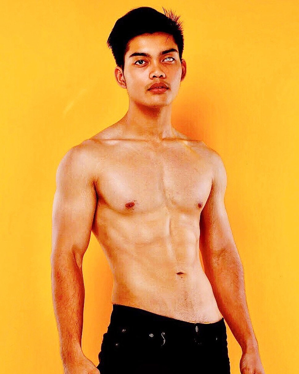 Wan Muhammad Aiman ชายผู้ถูกรังแกในวัยเด็กจนสูญเสียตาข้างหนึ่ง สู่ ...