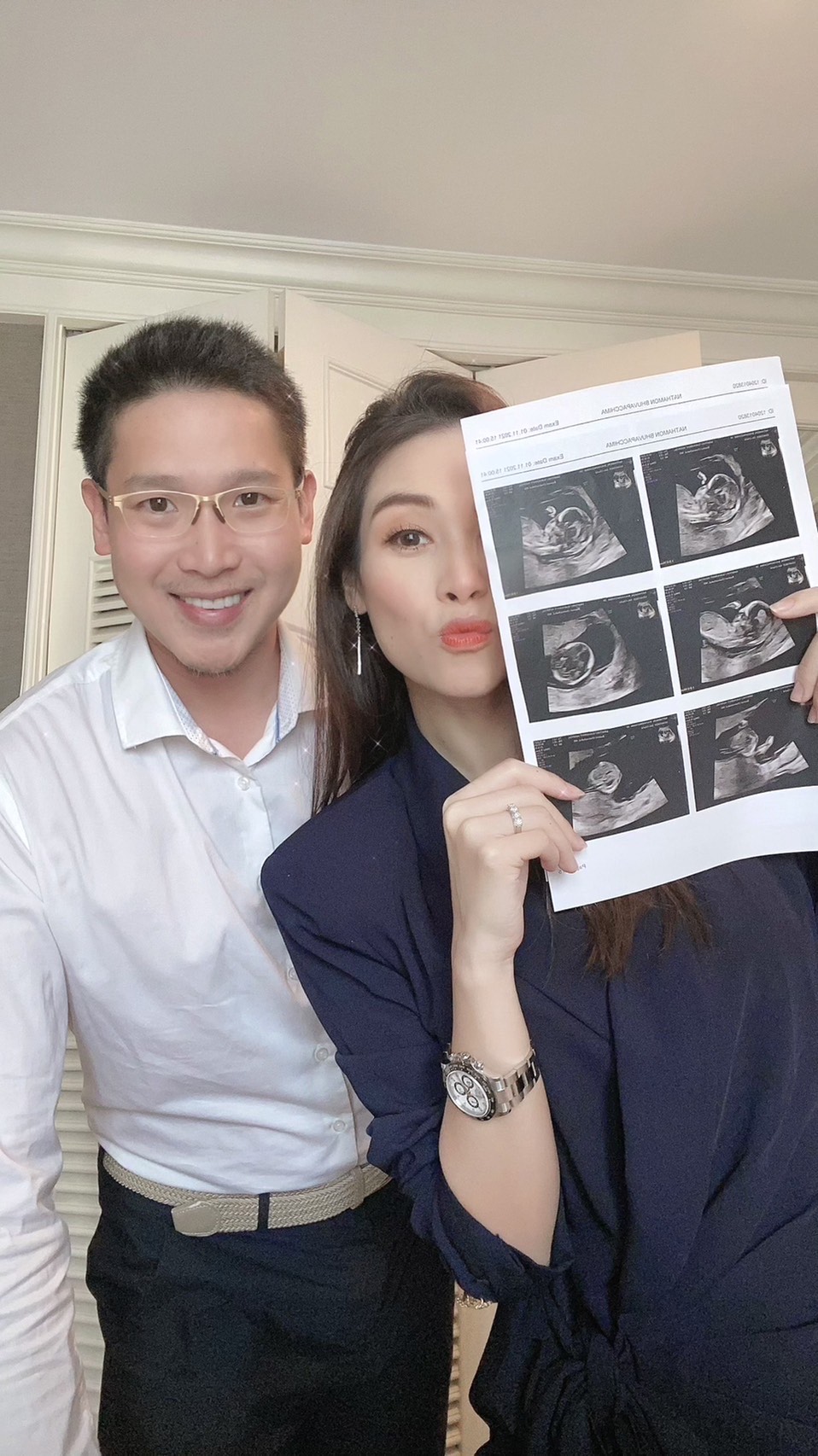 ปอ ณฐมน ว่าที่คุณแม่มือใหม่ ประกาศท้องแล้วจ้า !!! ควงสามี ดัง- สุทธิ ...